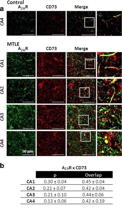 Ecto 5′ Nucleotidasecd73 Partially Co Localizes With The Adenosine A2a