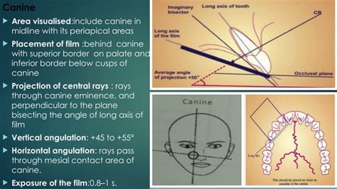 Bisecting Angle Technique Radiology Ppt Pptx