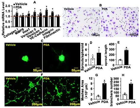 Pda Promotes Vascular Endothelial Cell Migration A Huvec Cs Were Download Scientific Diagram