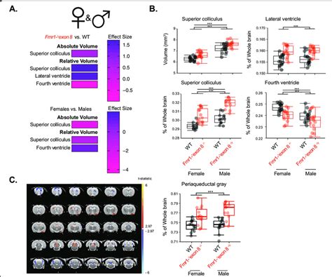 Absolute And Relative Brain Region Volumes Of Male And Female Wt And