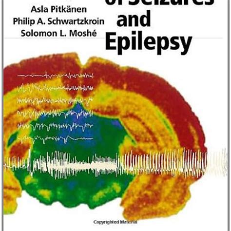 Models Of Seizures And Epilepsy百度百科