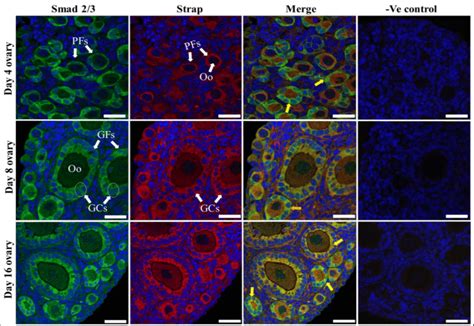 14 Co Localisation Of Strap And Smad23 Proteins In Small Follicles