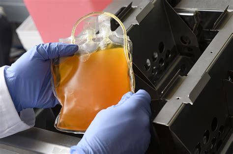 Convalescent Plasma Shows Renewed Promise For Covid 19 In Outpatient