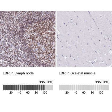 Lamin B Receptor Antibody Pa5 62061