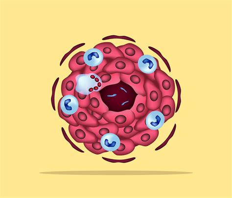 O que é um granuloma Blog Jaleko