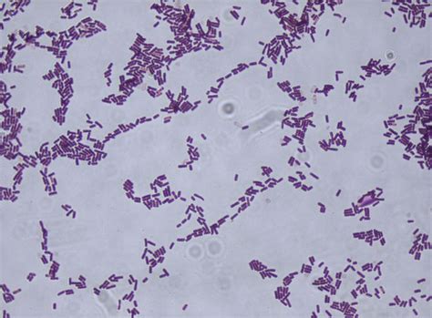 Bacillus Subtilis Bacilli In Chains Gram Bacillus Subtilis