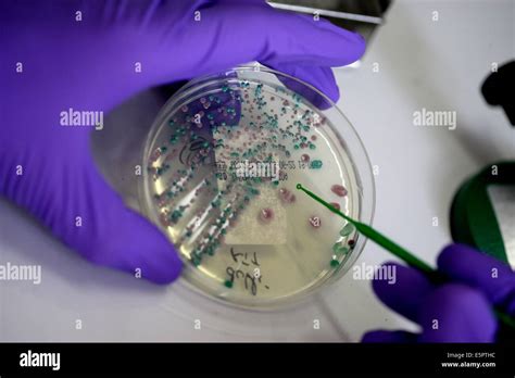Microscopic Pathogenic Fungi