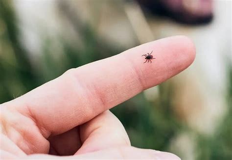 Tick Bite First Aid