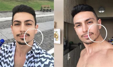 COMECEI A USAR MINOXIDIL NA BARBA Semanas Homens Que Se Cuidam