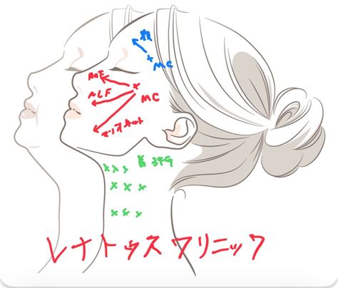Gouri（ゴウリ）注射が安い¥39 600〜¥53 900 医療脱毛専門美容皮膚科レナトゥスクリニック