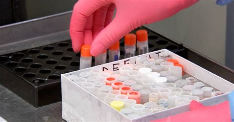 Cdc Issues Warning About Skin Disfiguring Parasite Infections Rise In