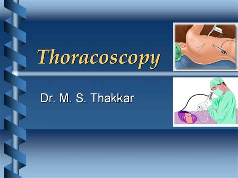 Ppt Thoracoscopy Powerpoint Presentation Free Download Id 771395