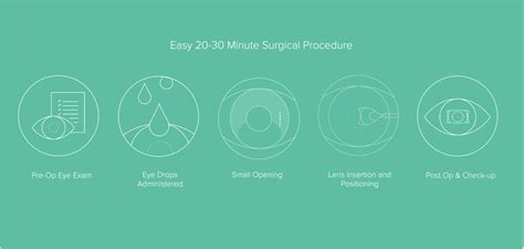 Surgical Prodecure Papale Eye Center