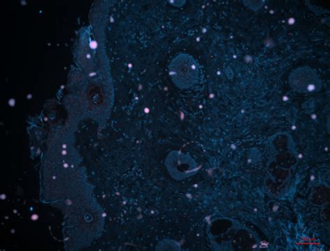 How To Get Rid Of The Blobs On My Immunofluorescence Slides Researchgate