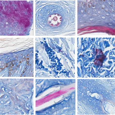 Histopathological Features Of The Nine Selected Skin Incisional Biopsy