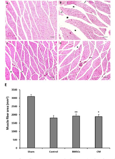 Figure From Bone Marrow Stromal Cell Conditioned Medium Regenerates Injured Sciatic Nerve By