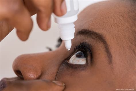 Fda Approves Generic Solution Of Cyclosporine Ophthalmic Emulsion For