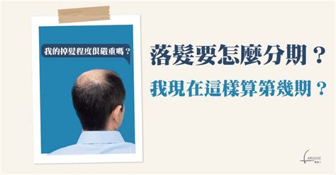 新冠肺炎確診副作用竟然會掉頭髮？ 雷射生髮帽arouse 雅諾士髮線青春