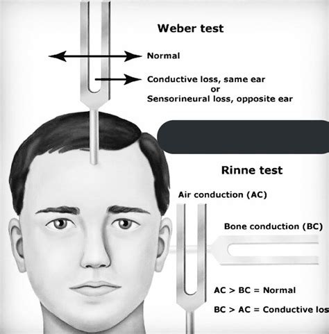 Weber Test Tuning Fork