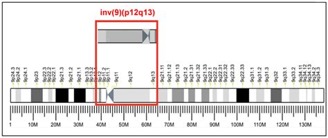Chromosome 9 Map
