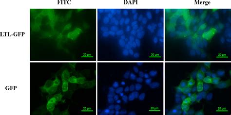 Frontiers Immunological Characterization And Function Analysis Of L Type Lectin From Spotted