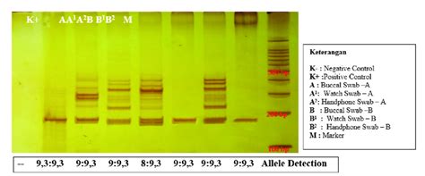 Visualization Of Str Codis Pcr Product Using At Locustho1 156 195 Bp