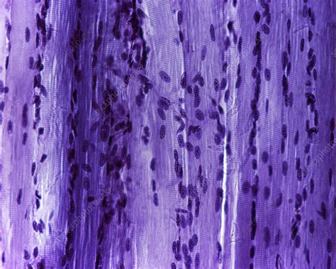 Skeletal Muscle Fibres Light Micrograph Stock Image C Science Photo Library
