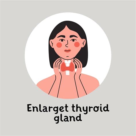 Woman Showing Enlarget Thyroid Gland On Her Neck Endocrinology System