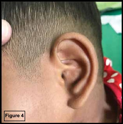 Post Operative Results Download Scientific Diagram