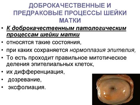 Фоновые предраковые и злокачественные заболевания женской половой