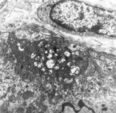 Transmission Electron Micrograph Of The Neuromuscular Junction In