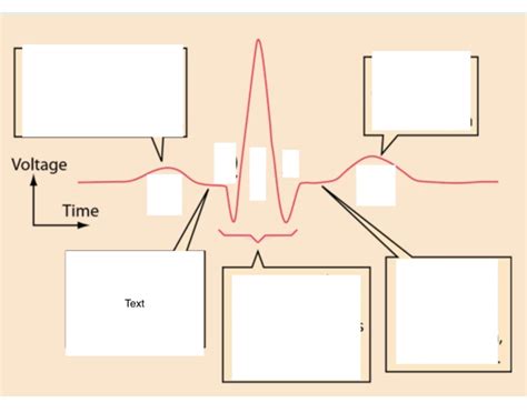 Ecg Graph Quiz — Printable Worksheet
