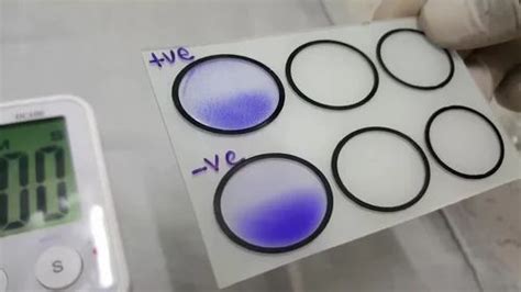 Liquid Widal Salmonella Antigen Test Kit 8x5ml For Laboratory At ₹ 250