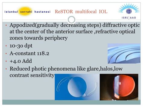 PPT Accomodative And Multifocal IOL Implantations PowerPoint