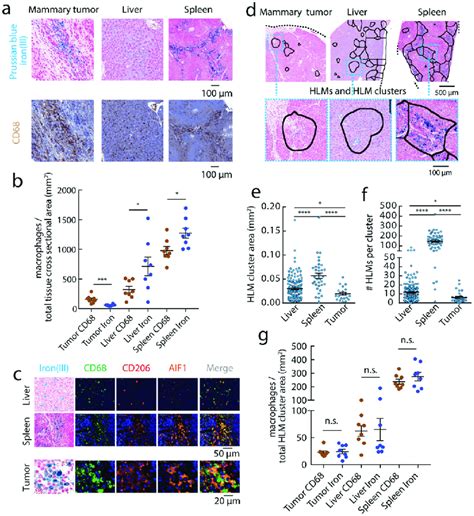Hemosiderin Iron Is A Biomarker Of Macrophage Deposits In Systemic And
