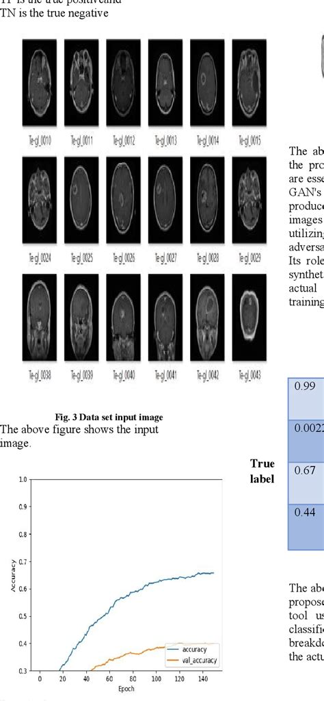 Figure 3 From Classification Of Brain Tumor Using Generative Adversarial Network With Res Net