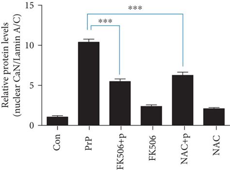 Fk506 Treatment Attenuates Prp 106 126 Induced Neurotoxicity Via Can