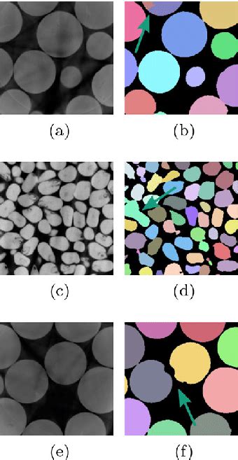 Typical Error Cases For The Classical Segmentation Pipeline A And B