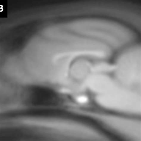 Feline Tissue Probability Maps That Were Created From 38 T1 Weighted