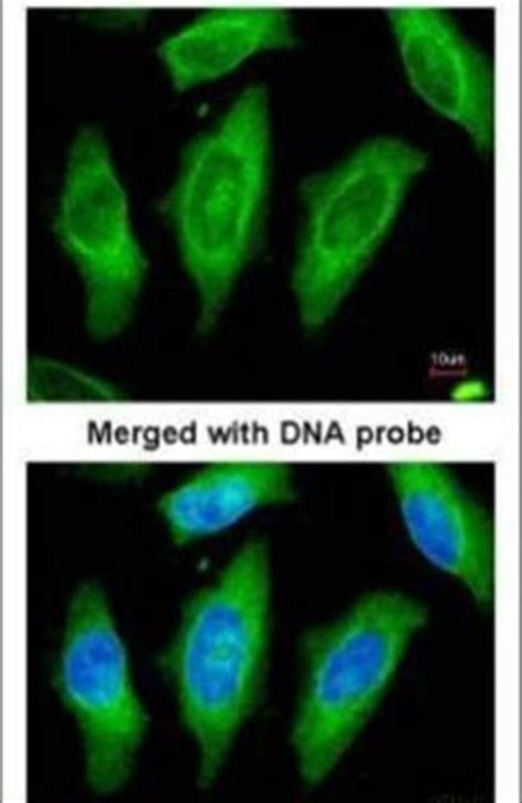 Mst3 Polyclonal Antibody Invitrogen 100 μl Unconjugated Antibodies