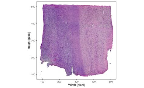 Spatial Segmentation • Spata2