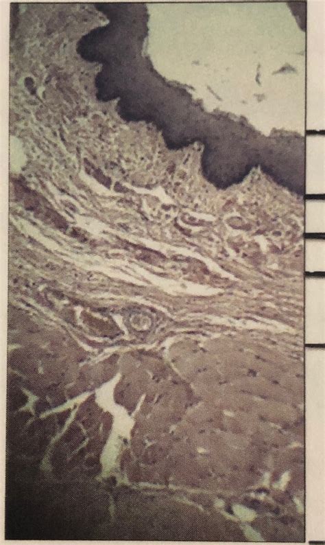Esophagus 2 Diagram Quizlet
