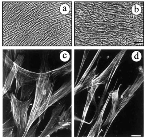 Phase Contrast Microscopy Photograph Of Fibroblasts Cultured For 48 H Download Scientific