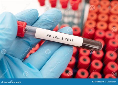 Hand Holding A Glass Of Test Tube With Patient`s Blood For Testing Nk
