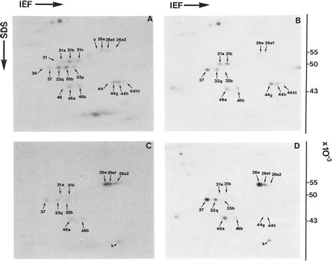 Two Dimensional Gel Electrophoresis Ief Of Download Scientific