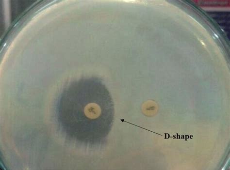 Methicillin And Inducible Clindamycin Resistant Staphylococcus Aureus