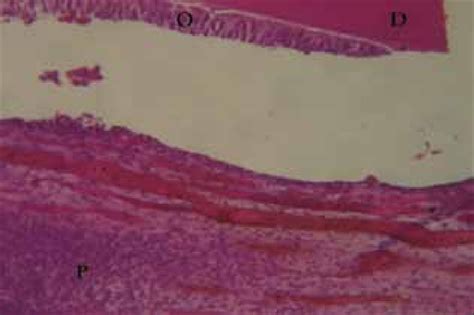 Histological Image Of The Pulp With Signs Of Hyperemia And Vasodilation