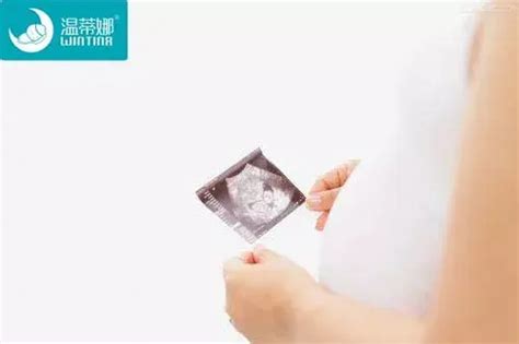 为什么怀孕前三个月不能和别人说？ 知乎
