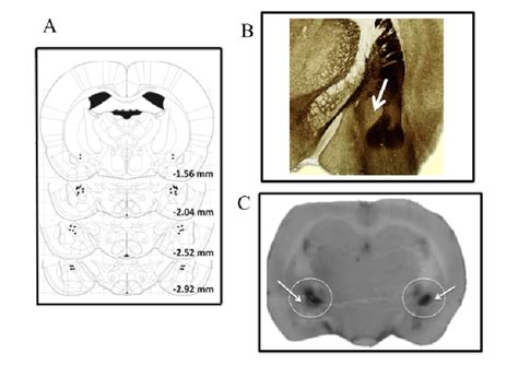 Figure S3 Schematic Sections From The Rat Brain Showing Injections Download Scientific Diagram