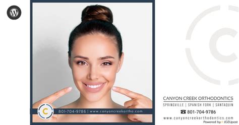 Understanding Teeth Spacing And 3 Important Implications Canyon Creek